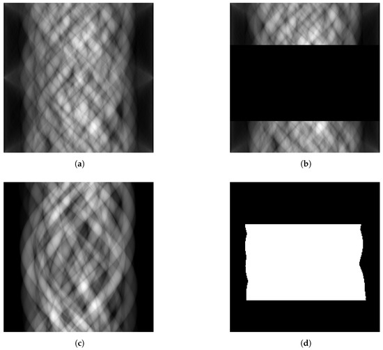 Sinogram Inpainting with Generative Adversarial Networks and Shape Priors
