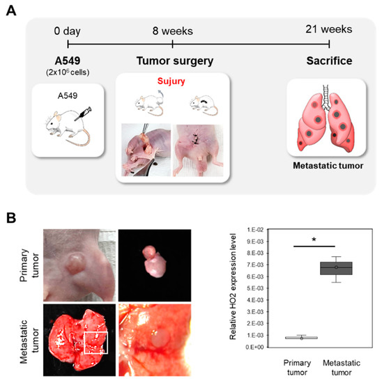 Visualization of Metastatic Lung Cancer with TiNIR