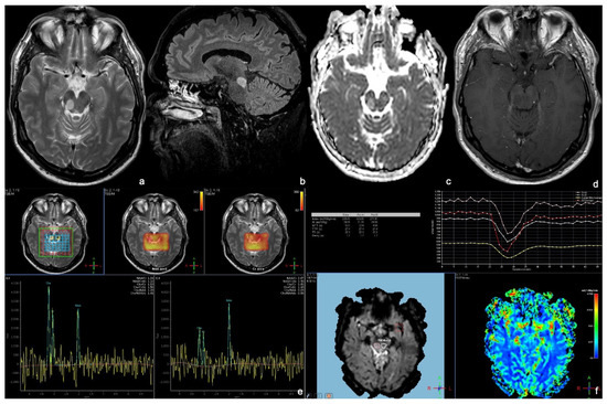 The Role of Advanced MRI Sequences in the Diagnosis and Follow-Up of ...