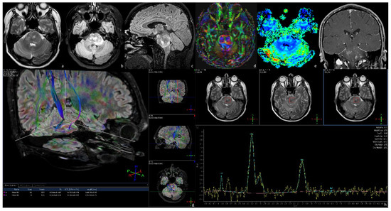 Tomography | Free Full-Text | The Role of Advanced MRI Sequences in the ...