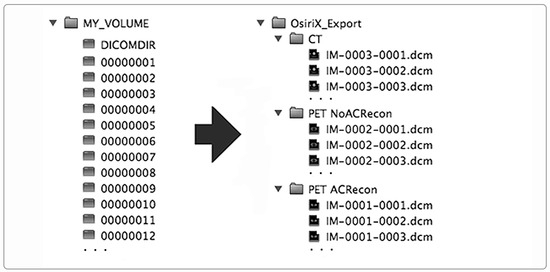 Thirty Years of the DICOM Standard