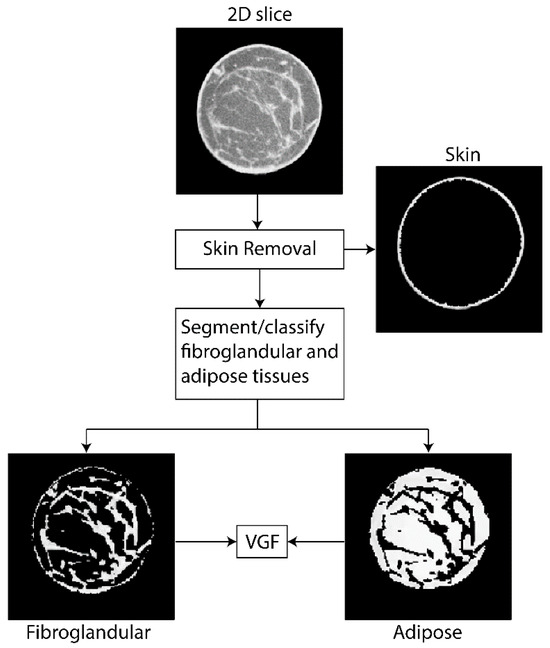 Dedicated Cone-Beam Breast CT: Reproducibility of Volumetric Glandular Fraction with Advanced ...