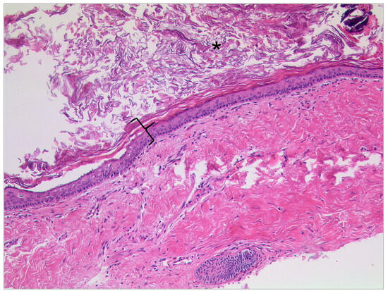Imaging of Pathologies of the Temporal Bone and Middle Ear ...