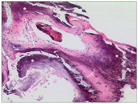 Imaging of Pathologies of the Temporal Bone and Middle Ear ...