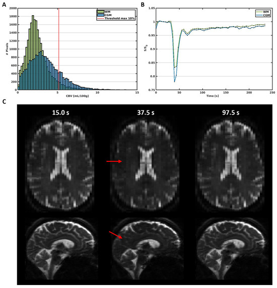 Cerebral Microvascular Perfusion Assessed in Elderly Adults by Spin ...