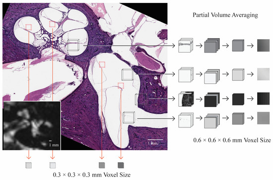 Patterns of Signal Intensity in CISS MRI of the Inner Ear and Eye