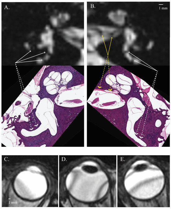 Patterns of Signal Intensity in CISS MRI of the Inner Ear and Eye
