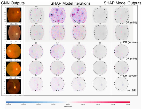Identifying Diabetic Retinopathy in the Human Eye: A Hybrid Approach ...