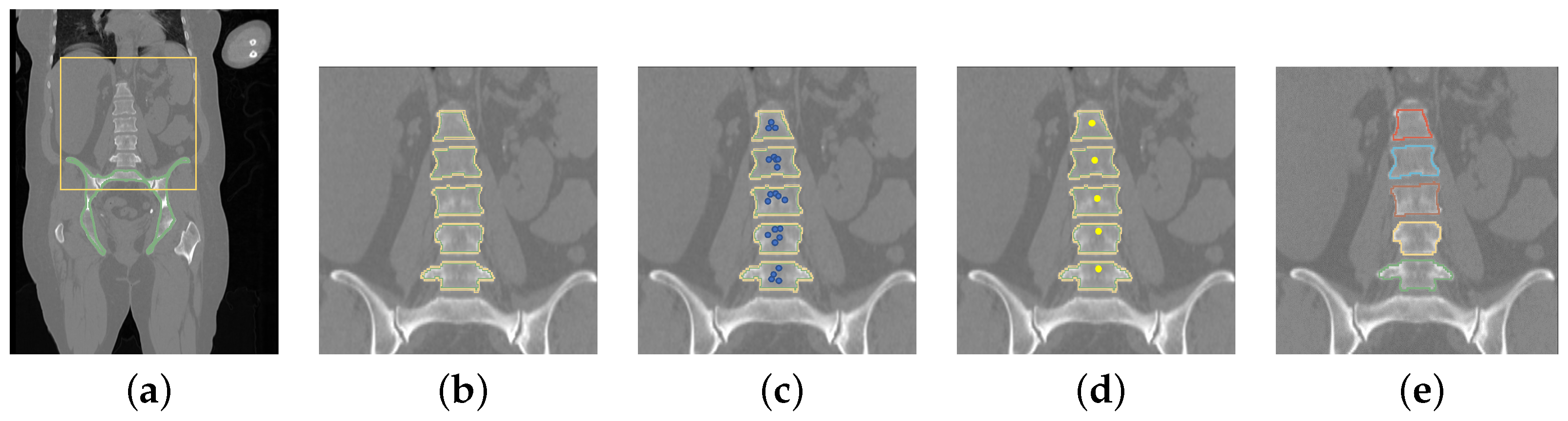 Lumbar and Thoracic Vertebrae Segmentation in CT Scans Using a 3D Multi-Object Localization and ...