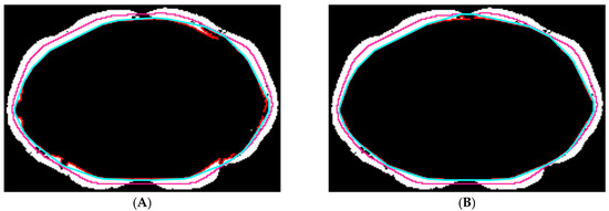 Skeletal Muscle Segmentation at the Level of the Third Lumbar Vertebra ...