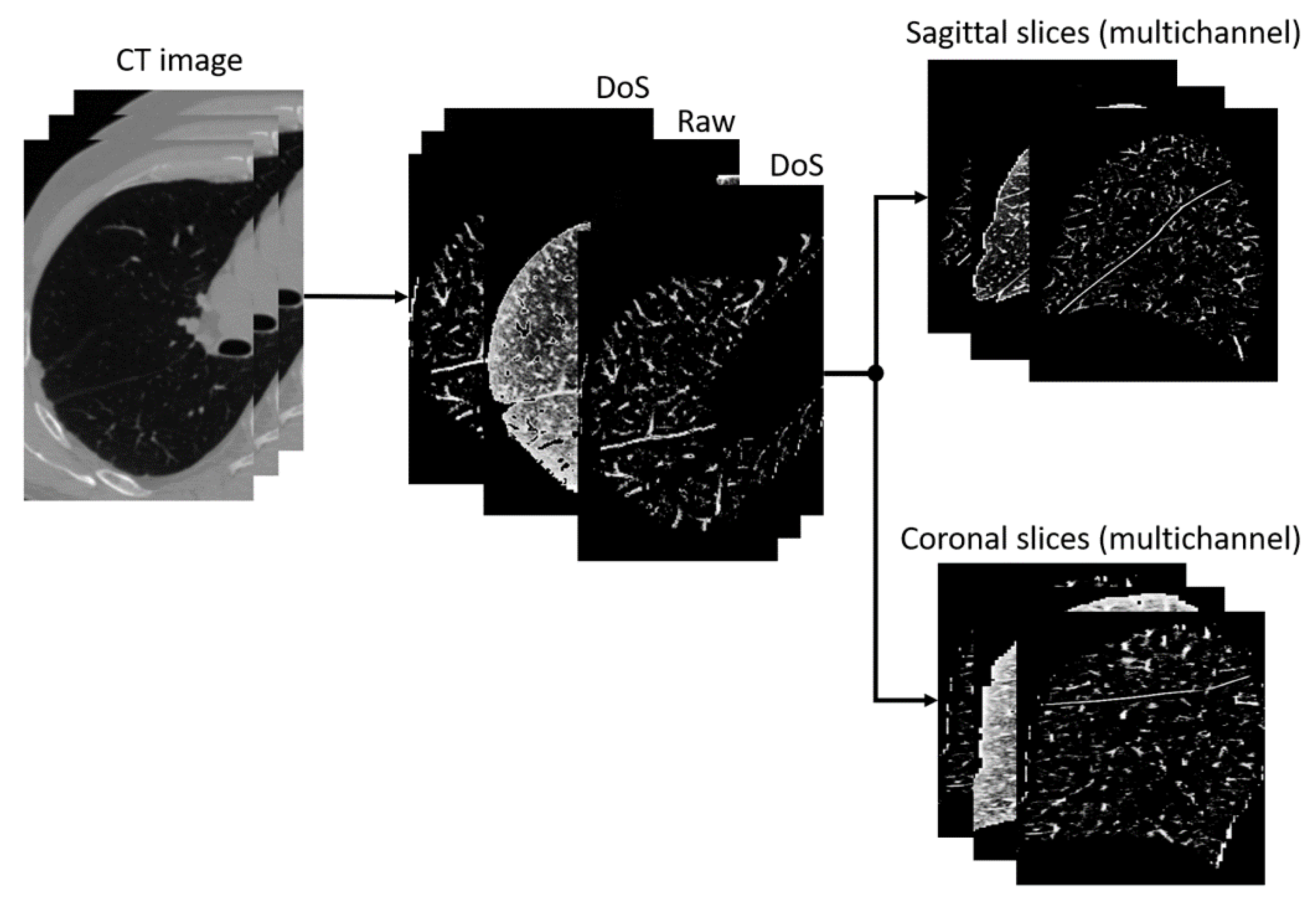 Pulmonary Fissure Segmentation in CT Images Using Image Filtering and Machine Learning