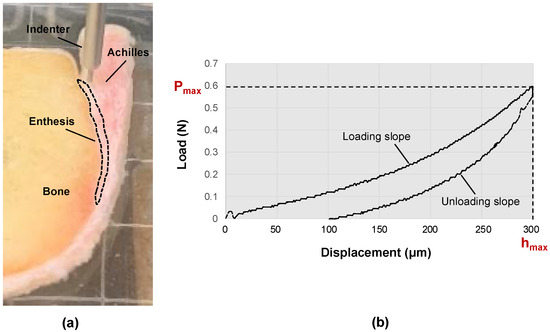 The Correlation between the Elastic Modulus of the Achilles Tendon ...