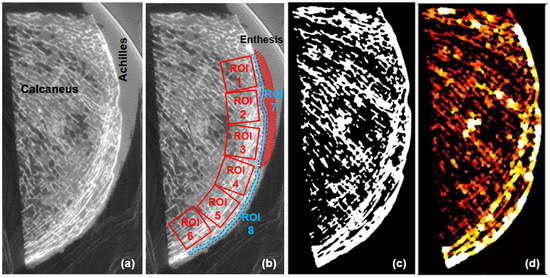 The Correlation between the Elastic Modulus of the Achilles Tendon ...