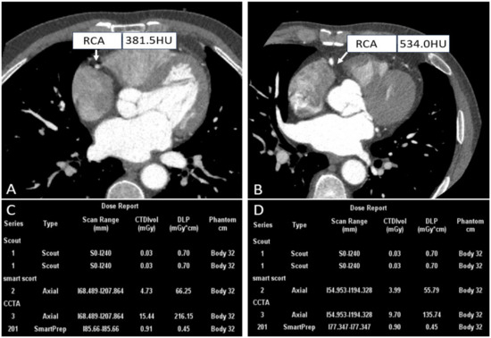 A Review of Factors Affecting Radiation Dose and Image Quality in ...