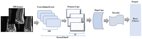 Enhanced Disc Herniation Classification Using Grey Wolf Optimization Based on Hybrid Feature ...
