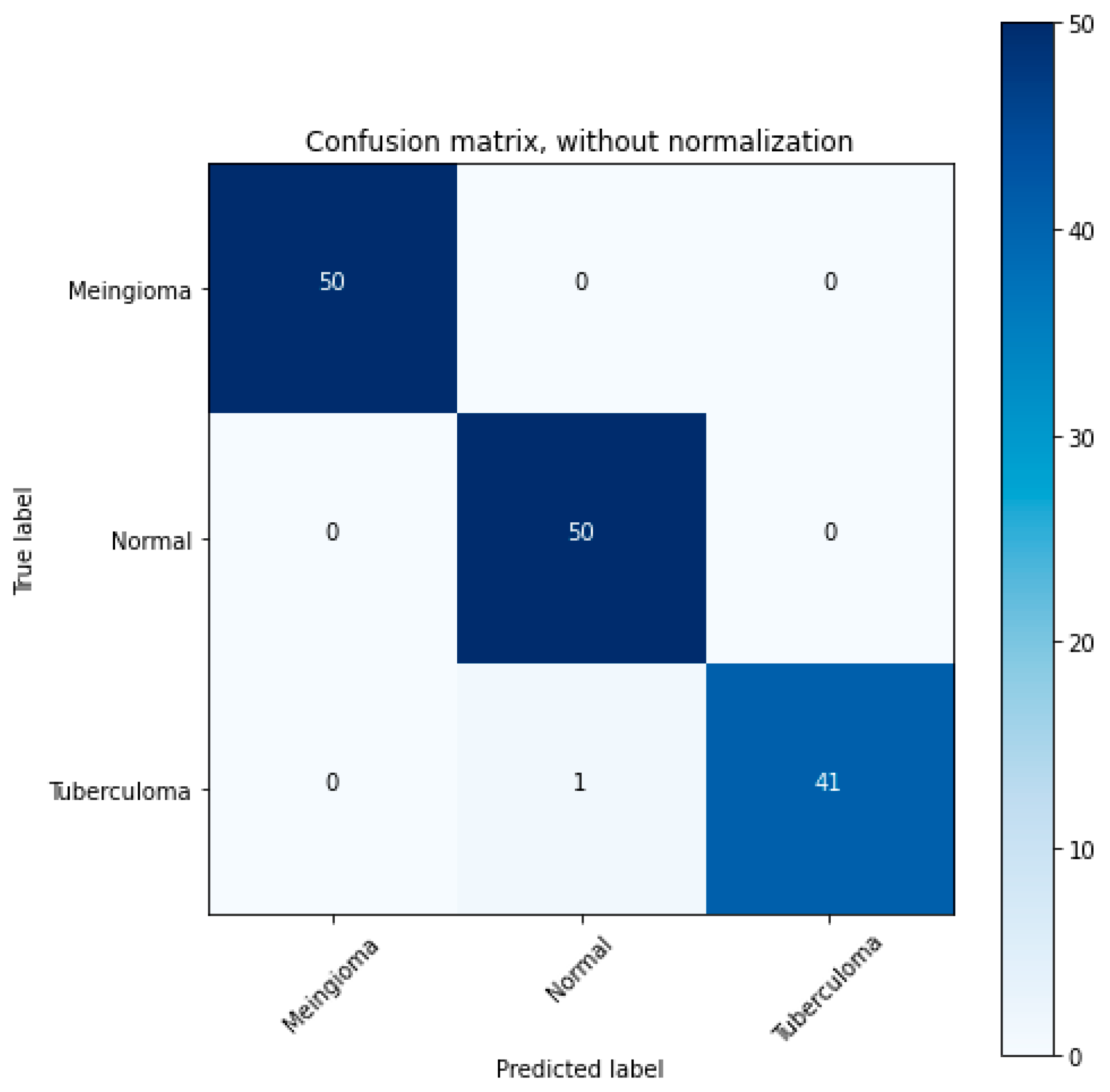 Real-Time Detection of Meningiomas by Image Segmentation: A Very Deep Transfer Learning ...
