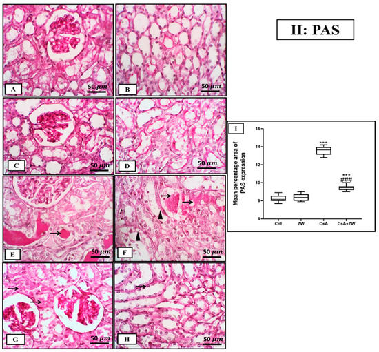 Palliative Role of Zamzam Water against Cyclosporine-Induced ...