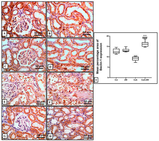 Palliative Role of Zamzam Water against Cyclosporine-Induced ...