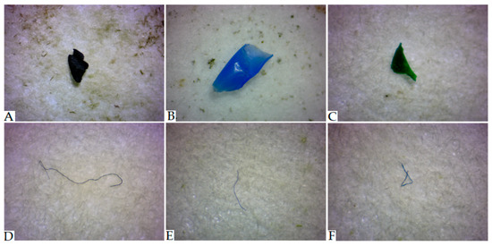 Application of Pattern Recognition and Computer Vision Tools to Improve the Morphological ...