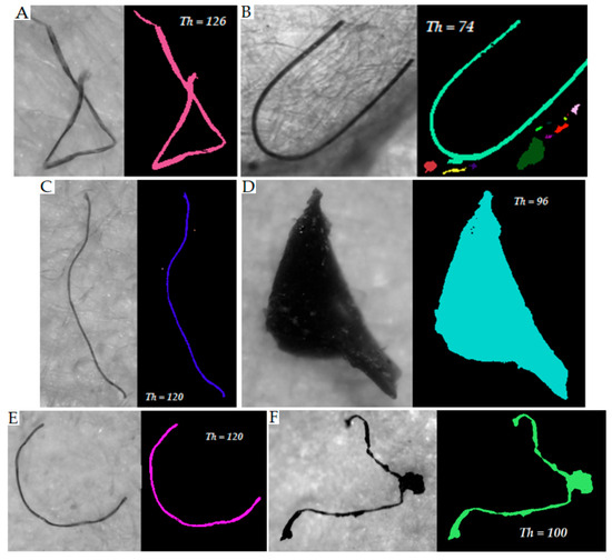 Application of Pattern Recognition and Computer Vision Tools to Improve the Morphological ...
