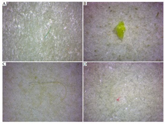 Application of Pattern Recognition and Computer Vision Tools to Improve the Morphological ...