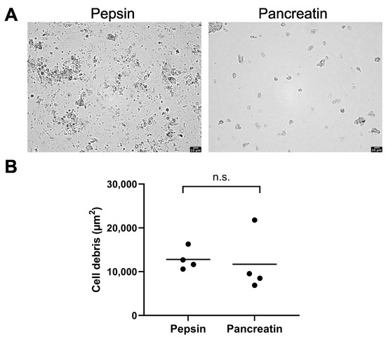 Toxics | Free Full-Text | Testing of Different Digestion Solutions on ...