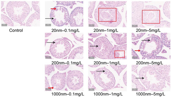 Toxicity to the Male Reproductive System after Exposure to Polystyrene ...