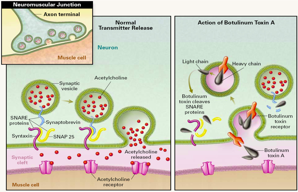 Sensing the Deadliest Toxin: Technologies for Botulinum Neurotoxin ...