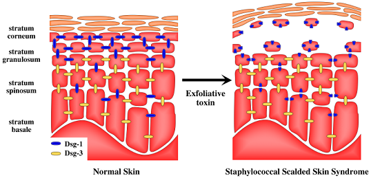 Toxins | Free Full-Text | Exfoliative Toxins of Staphylococcus aureus