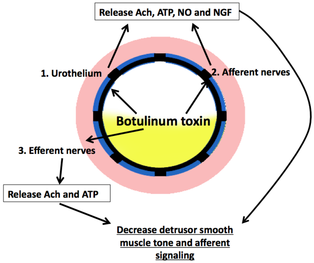 Toxins | Special Issue : Botulinum Toxin A on Lower Urinary Tract ...