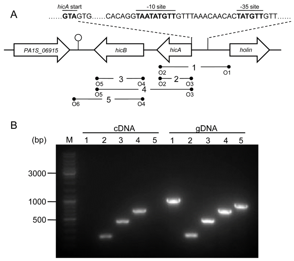 Toxins | Special Issue : Toxin-Antitoxin System in Bacteria