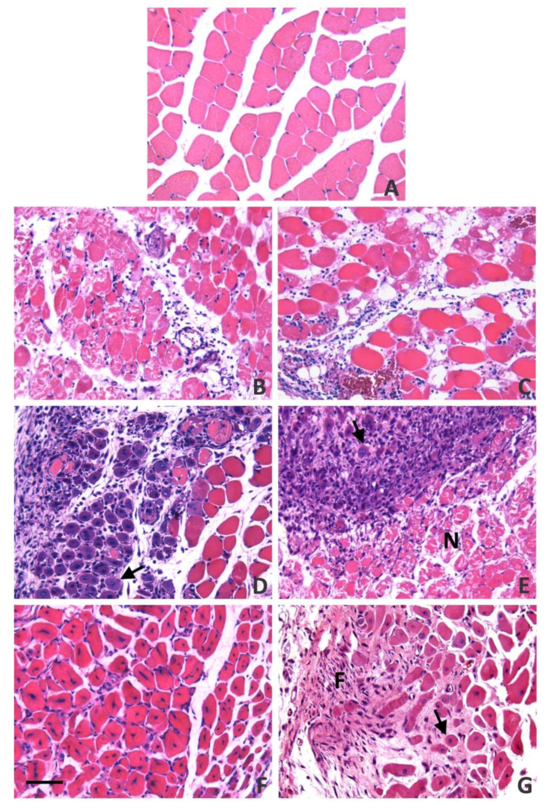 Toxins | Free Full-Text | Why is Skeletal Muscle Regeneration Impaired ...