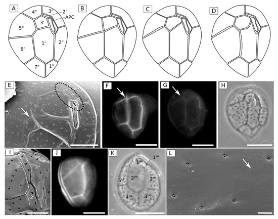 Ostreopsis cf. ovata Bloom in Currais, Brazil: Phylogeny, Toxin Profile ...