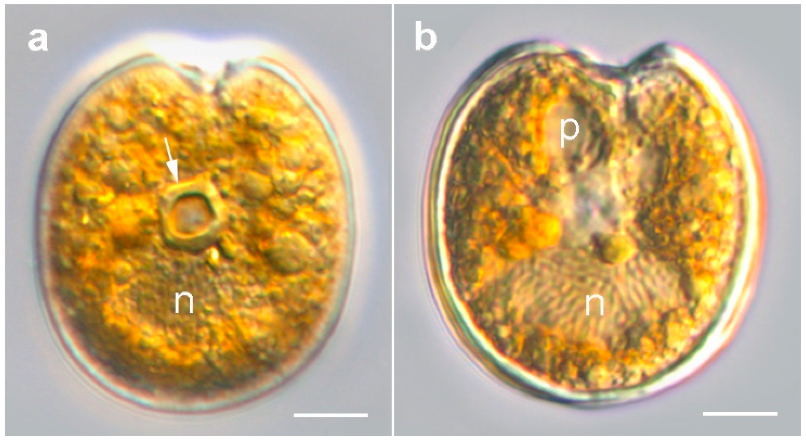Morphology and Phylogenetics of Benthic Prorocentrum Species ...