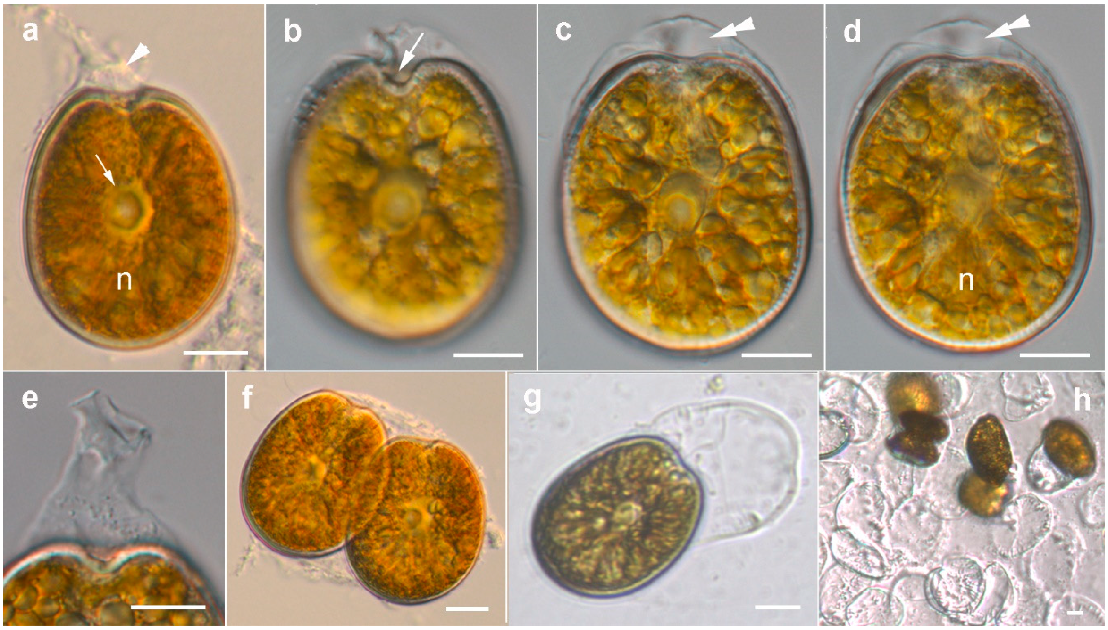 Morphology and Phylogenetics of Benthic Prorocentrum Species ...