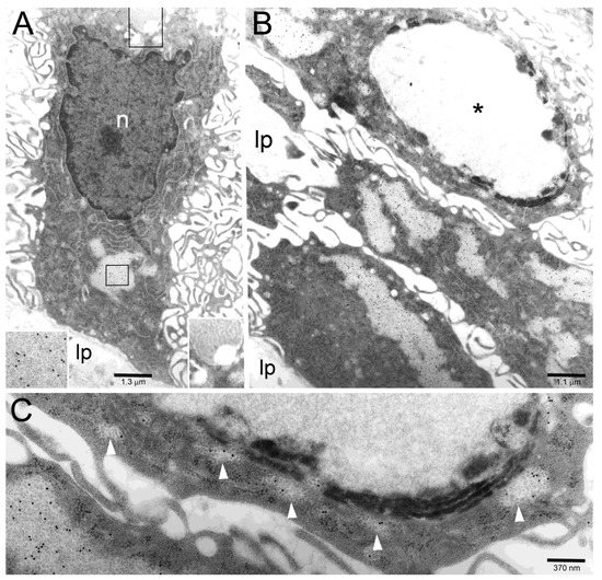 CagA Effector Protein in Helicobacter pylori-Infected Human Gastric ...