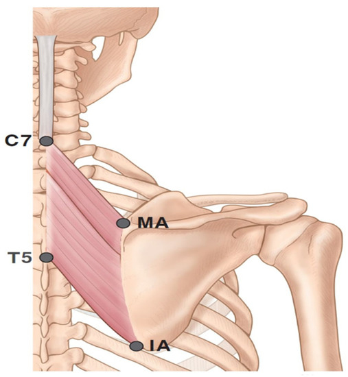 Intramuscular Neural Distribution of Rhomboid Muscles: Evaluation for ...