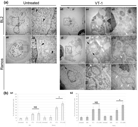 Verotoxin-1-Induced ER Stress Triggers Apoptotic or Survival Pathways ...