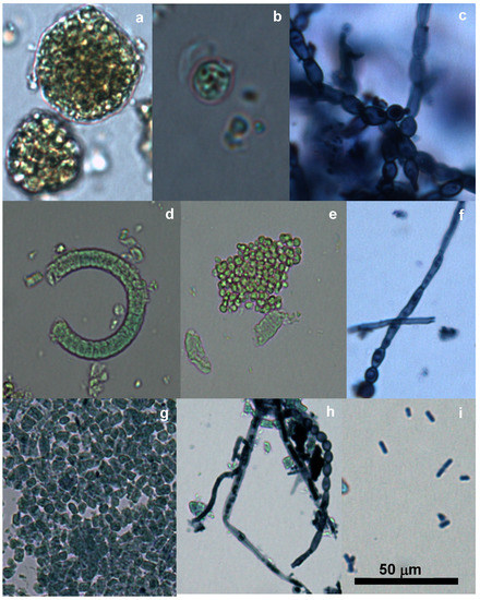 Are Cyanotoxins the Only Toxic Compound Potentially Present in ...