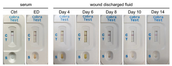 Local Cytotoxic Effects in Cobra Envenoming: A Pilot Study