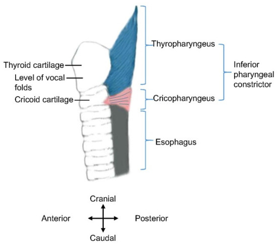 Botulinum Toxin Injection for the Treatment of Upper Esophageal ...
