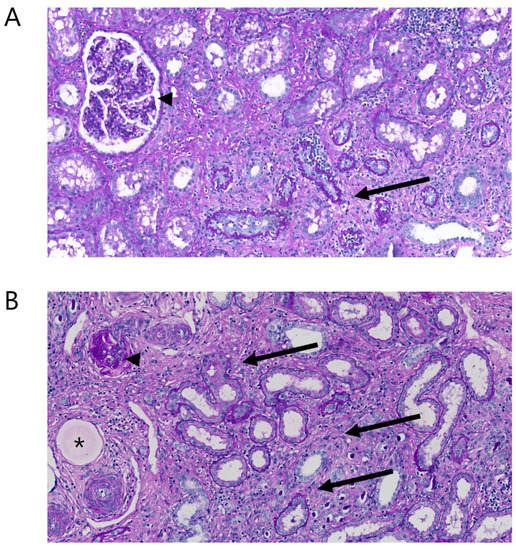 A Uremic Pig Model for Peritoneal Dialysis