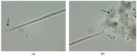 Cuspidothrix Is the First Genetically Proved Anatoxin A Producer in ...