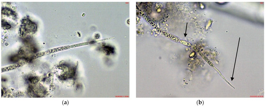 Cuspidothrix Is the First Genetically Proved Anatoxin A Producer in ...