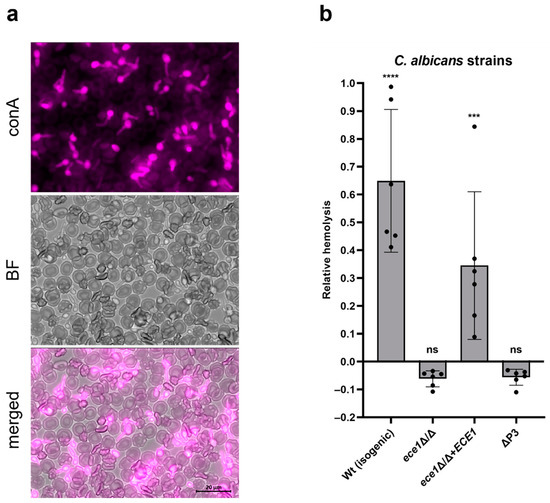 Candidalysin Is the Hemolytic Factor of Candida albicans
