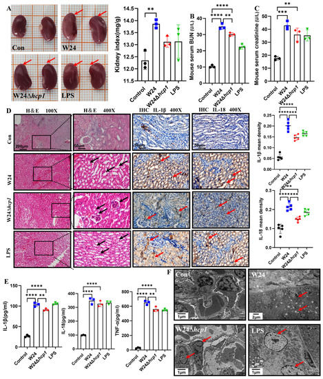 Hemolysin Co-Regulatory Protein 1 Enhances the Virulence of Clinically ...