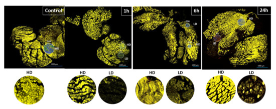 Mapping the Immune Cell Microenvironment with Spatial Profiling in ...