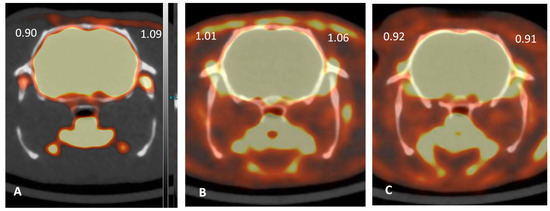 Efficacy of Intra-Articular Injection of Botulinum Toxin Type A ...
