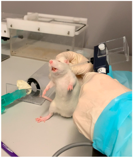 Efficacy of Intra-Articular Injection of Botulinum Toxin Type A ...