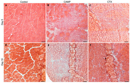 Toxins | Free Full-Text | Intramuscular Bleeding and Formation of ...